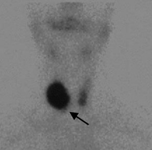 Thyroid Imaging - Thyroid Clinic Sydney